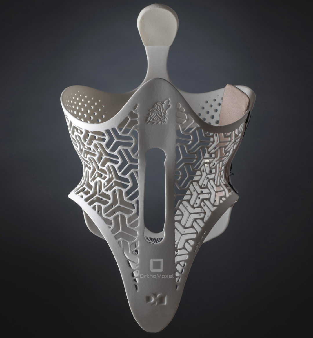 ORTHOVOXEL O & P 3D Printing I Orthopédie I RÉALISATION D’ORTHÈSES ET ...